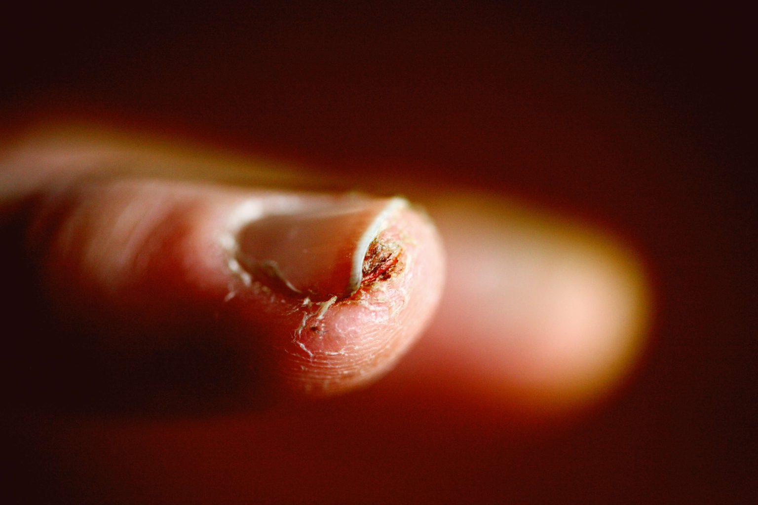 What Brittle Nails Say About Your Nutrition and Hormones | Bubolo Medical