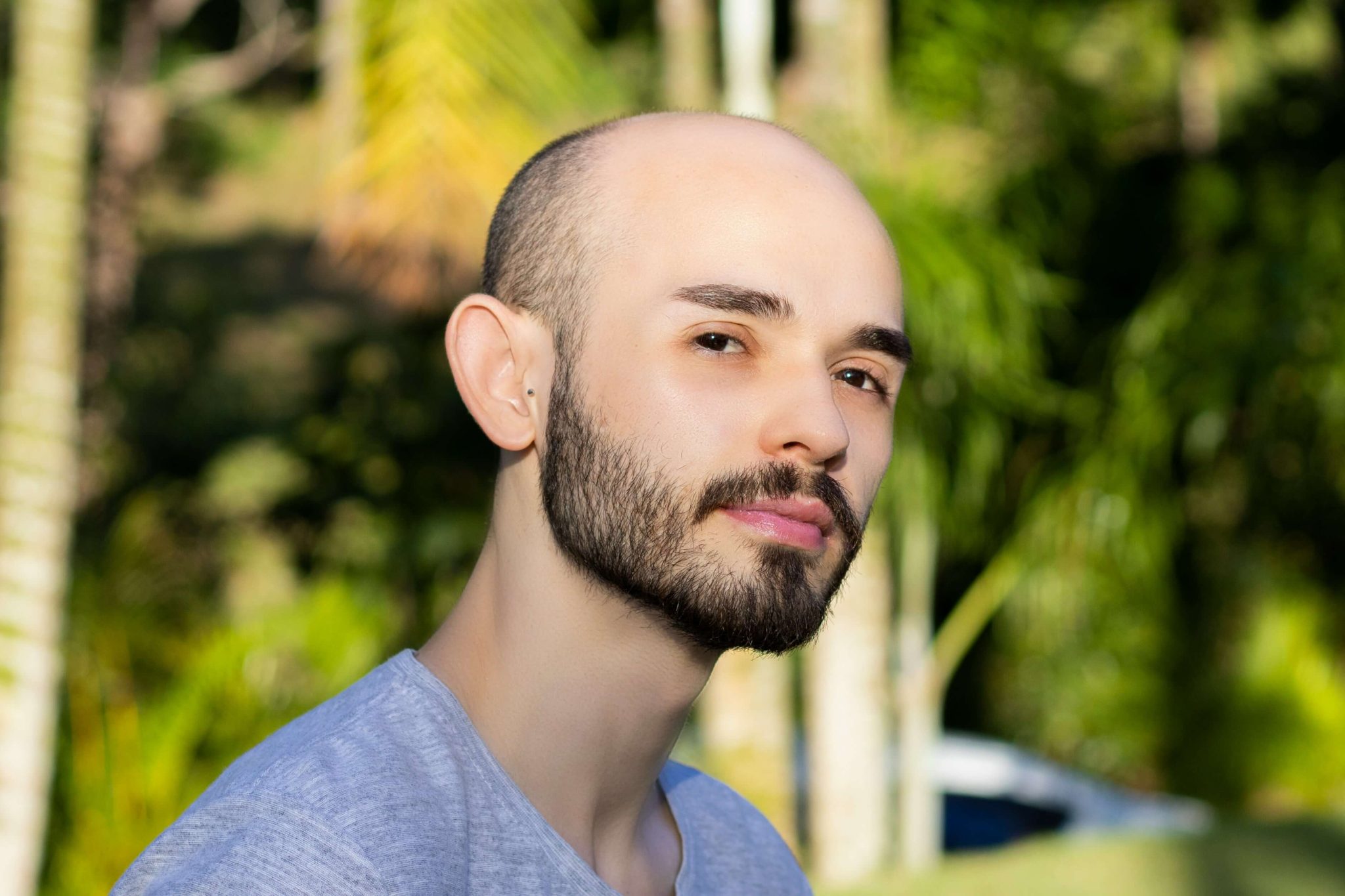 Understanding Hair Loss: What’s Normal, What’s Not, and When to Get ...